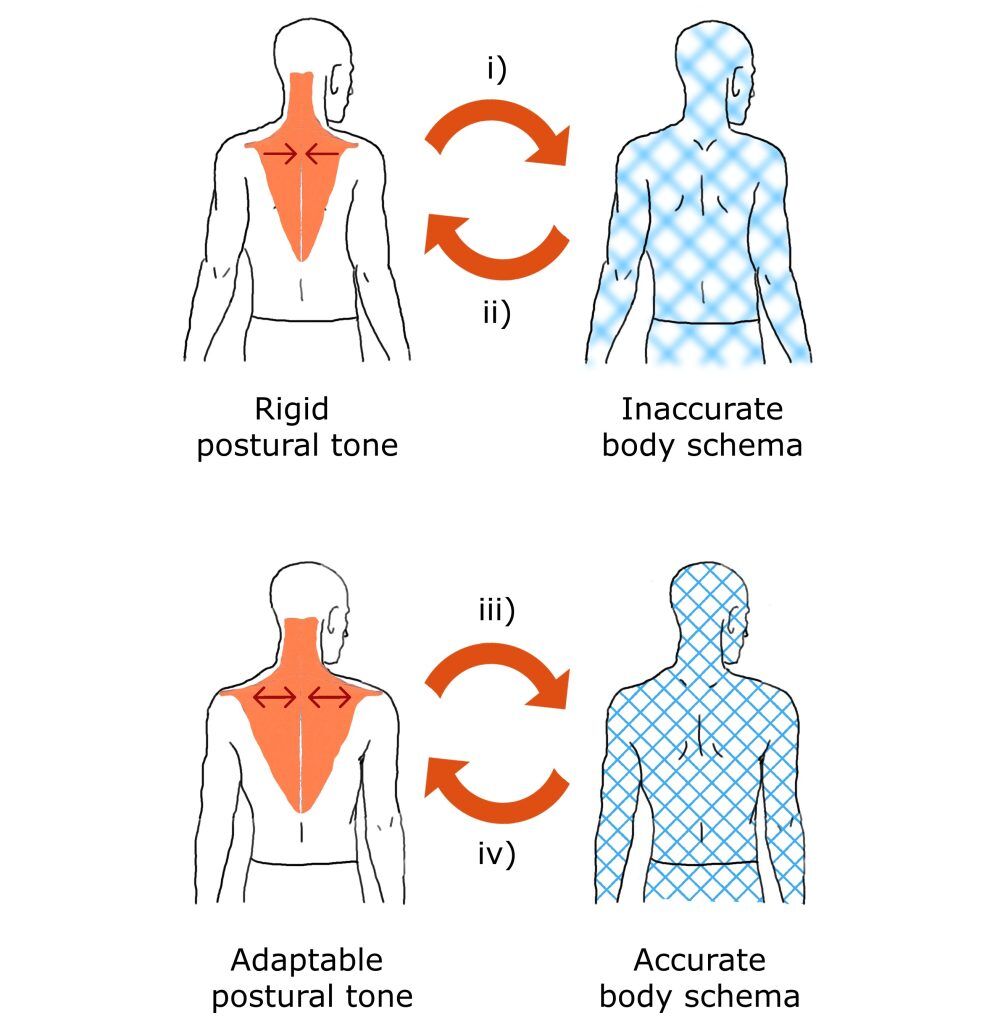 Why your map matters: body schema and postural tone | Bristol Alexander ...