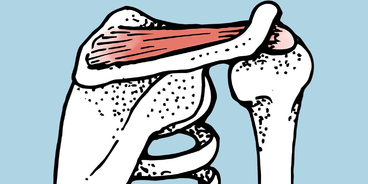 Hypermobility and the Alexander Technique | Bristol Alexander Studio